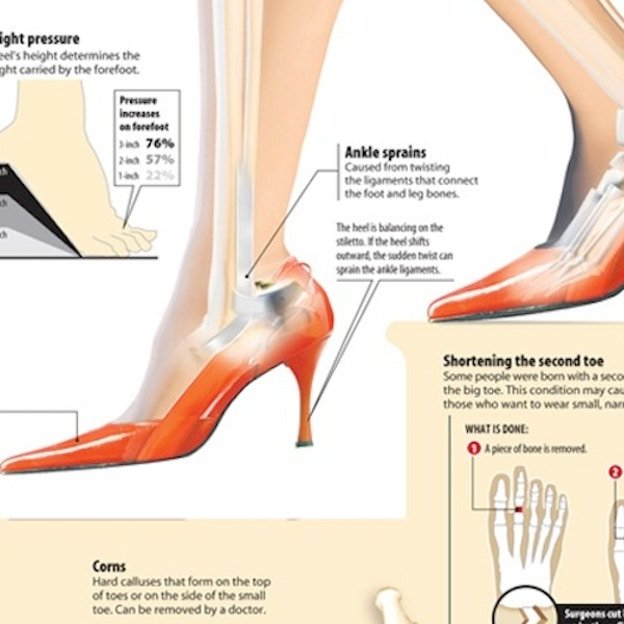 Is The Risk Of Wearing These Worth It? - Upworthy