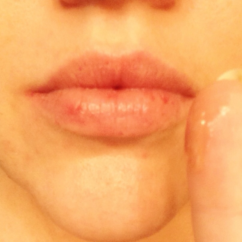 Why Get White Spots On Lips Reddit - Infoupdate.org