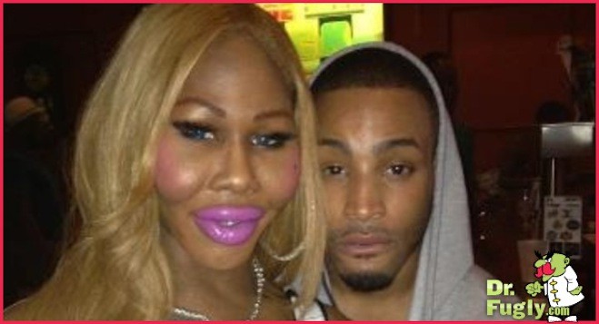 Trout Pout Catastrophes 20 Plastic Surgery Smacker Disasters Popdust